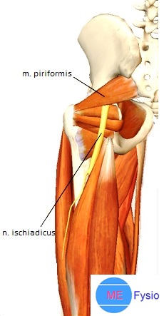 Piriformis Syndroom: Dit Zijn Symptomen Waar Je Op Moet Letten – ONZVM